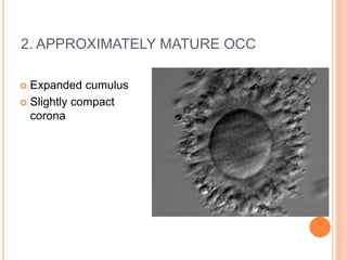 Oocyte grading.pptx... dhsvsusvshshhshsh | PPTX