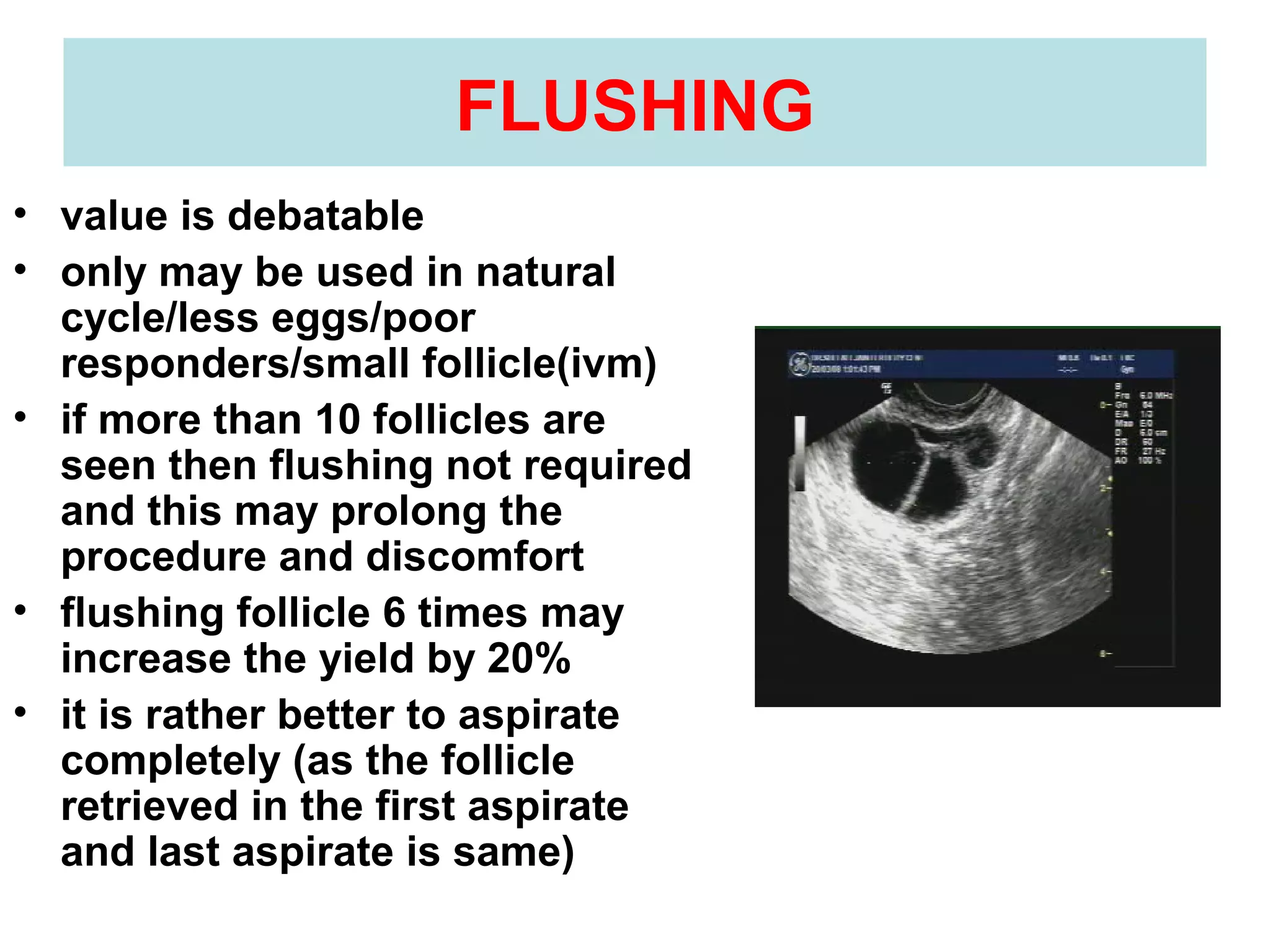 Oocyte retrival | PPT