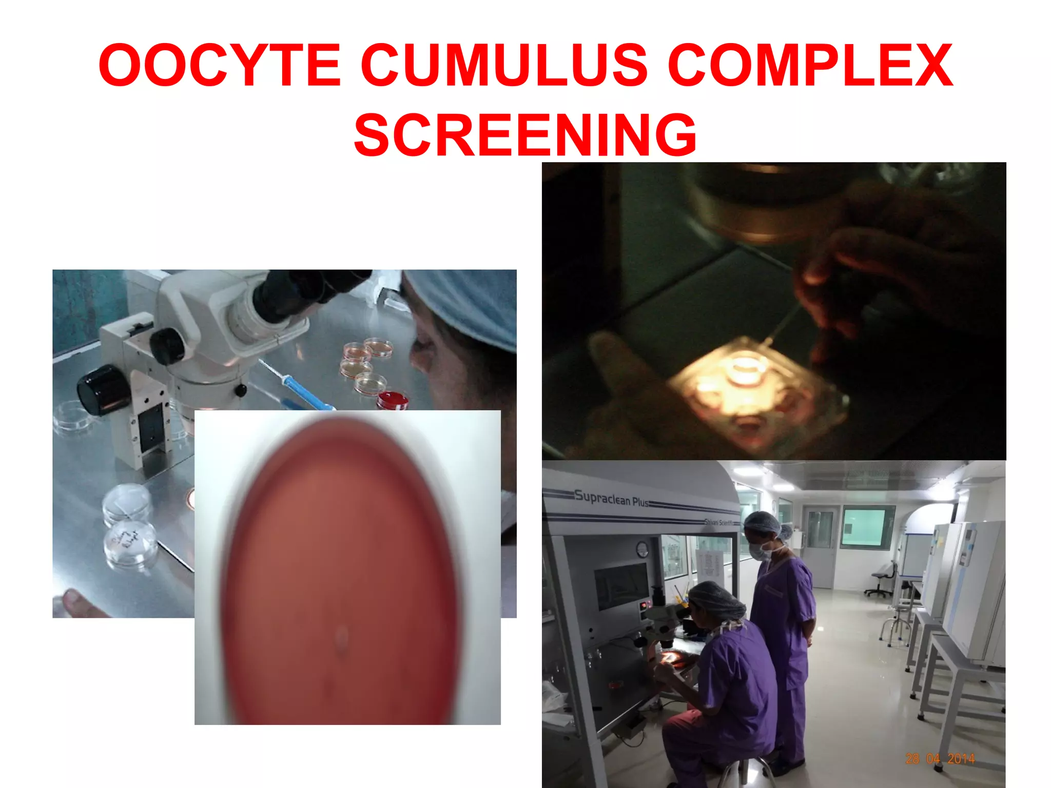 Oocyte retrival | PPT
