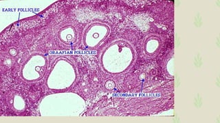 Ovary Slide Labeled Graafian Follicle