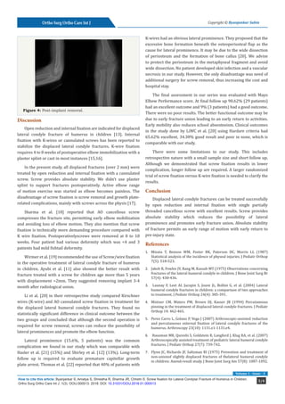 Screw fixation for Lateral Condylar Fracture of Humerus in Children | PDF