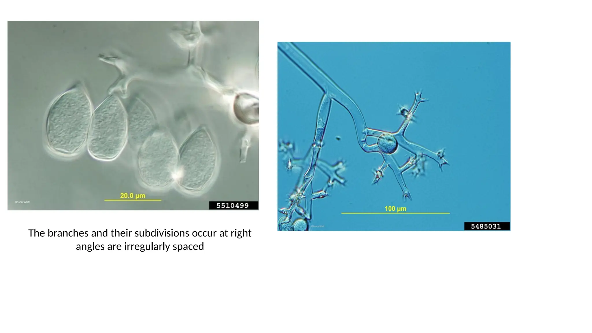 Oomycota: Unveiling Oomycota: Eukaryotic Plant Pathogens- The Water ...