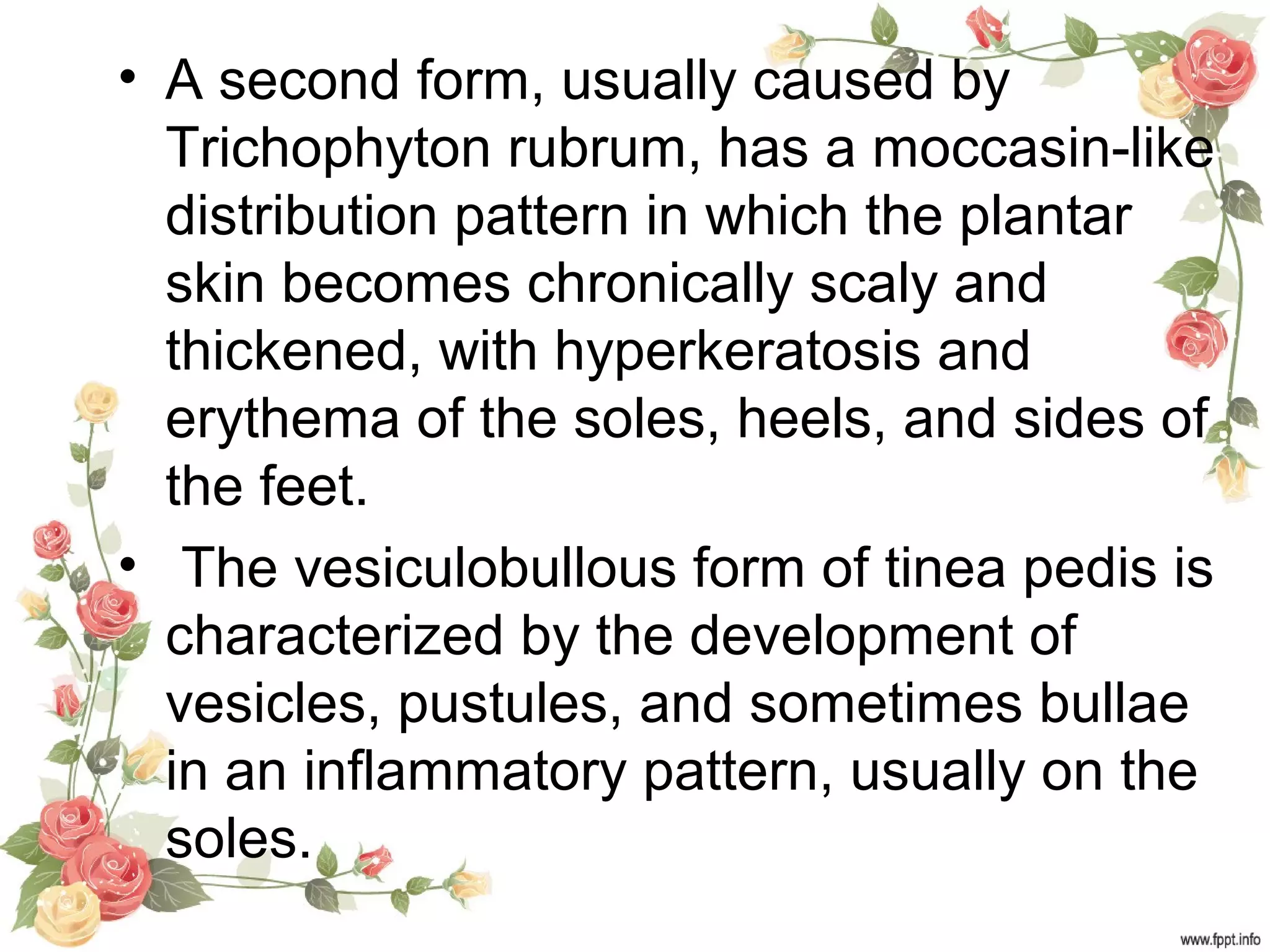 fungal infection of skin ppt | PPT