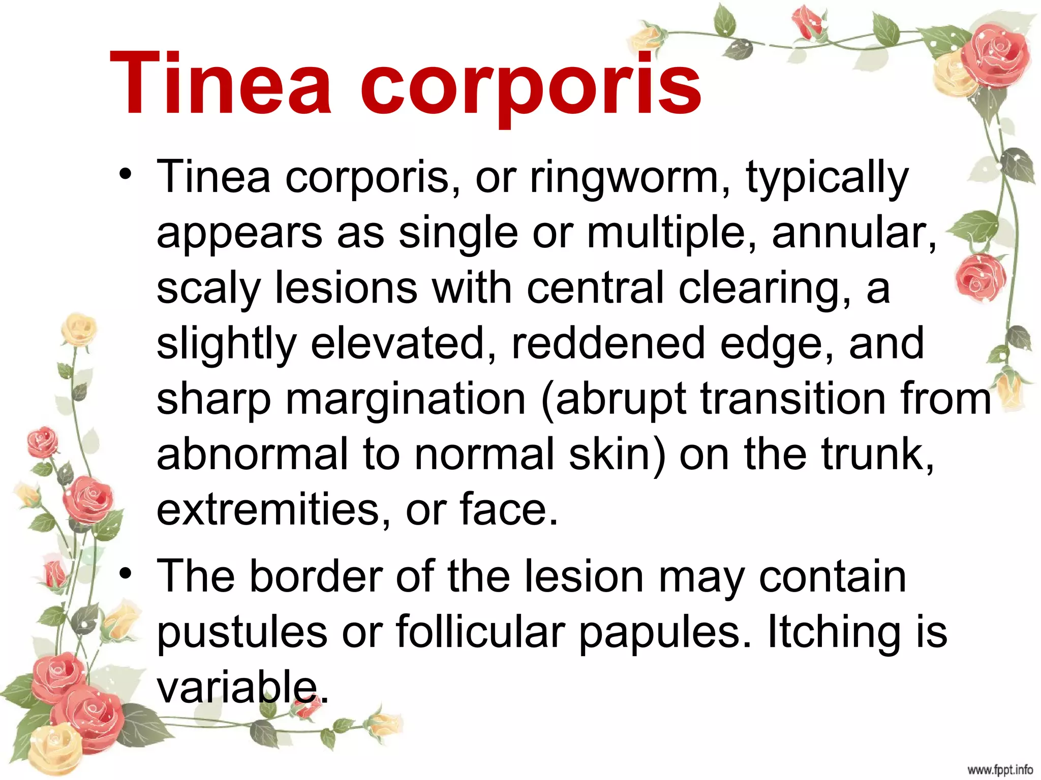 fungal infection of skin ppt | PPT