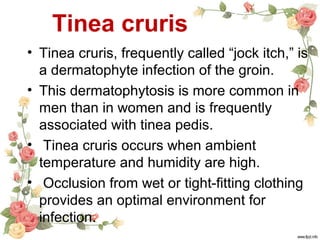 fungal infection of skin ppt | PPT