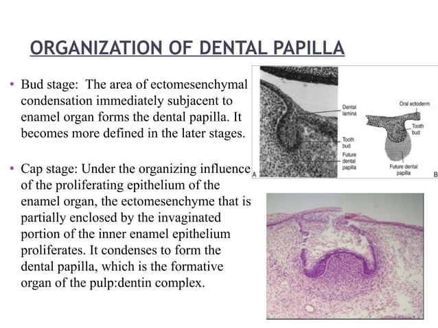 dentinogenesis, formation of dentin and its mineralisation | PPTX | Dental Health | Diseases and ...