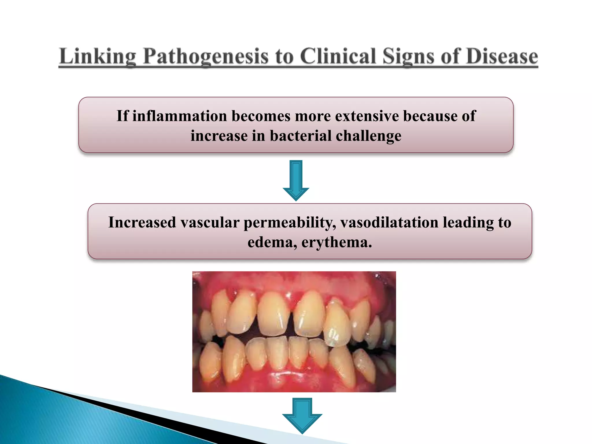 Periodontal pathogenesis | PPTX
