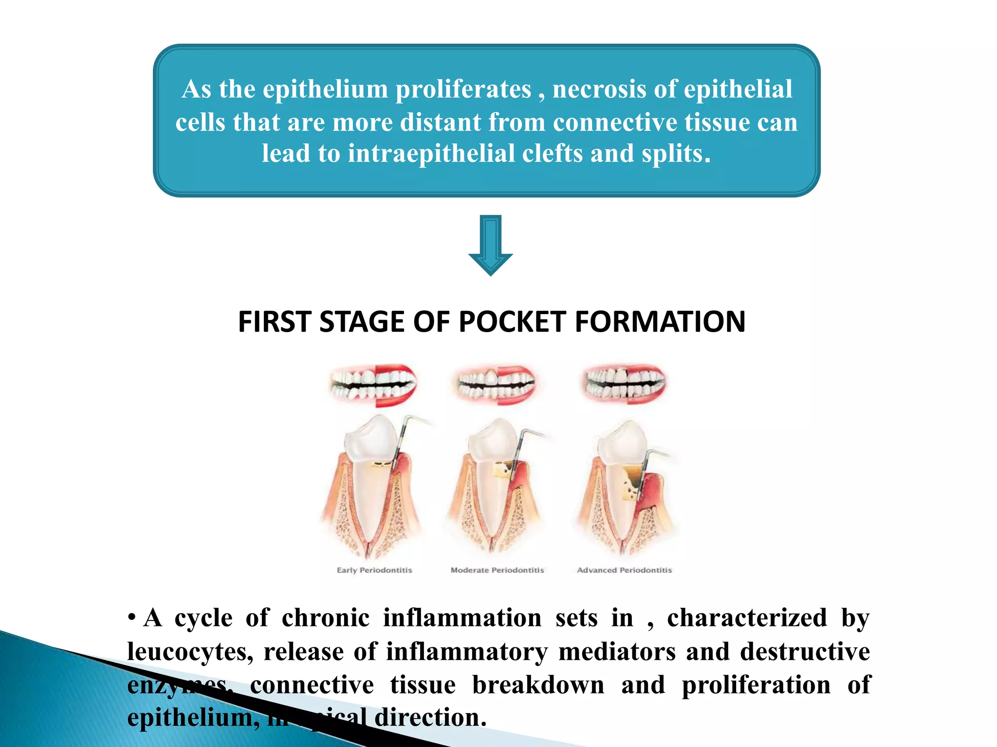 Periodontal pathogenesis | PPTX