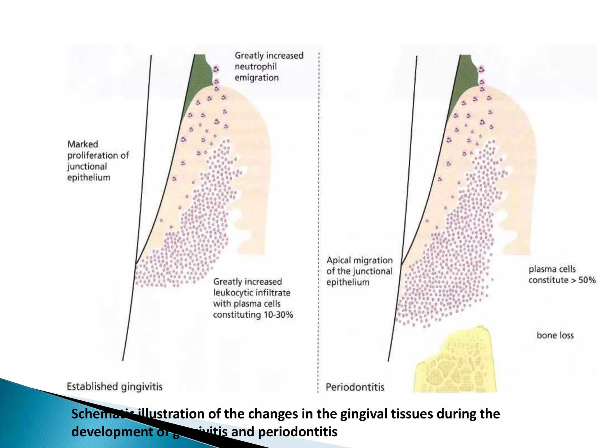 Periodontal pathogenesis | PPTX