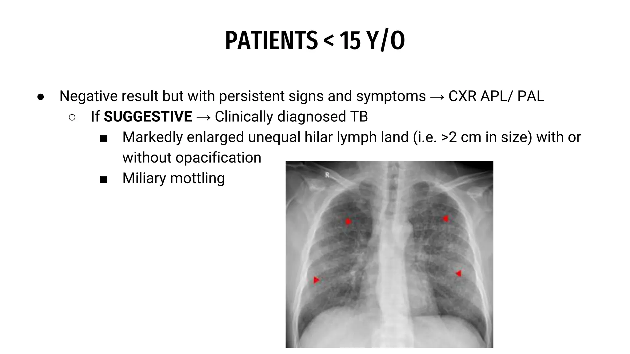 OPD-TUBERCULOSIS LECTURE.pptx