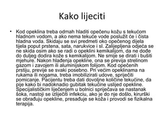 Opekotine | PPT
