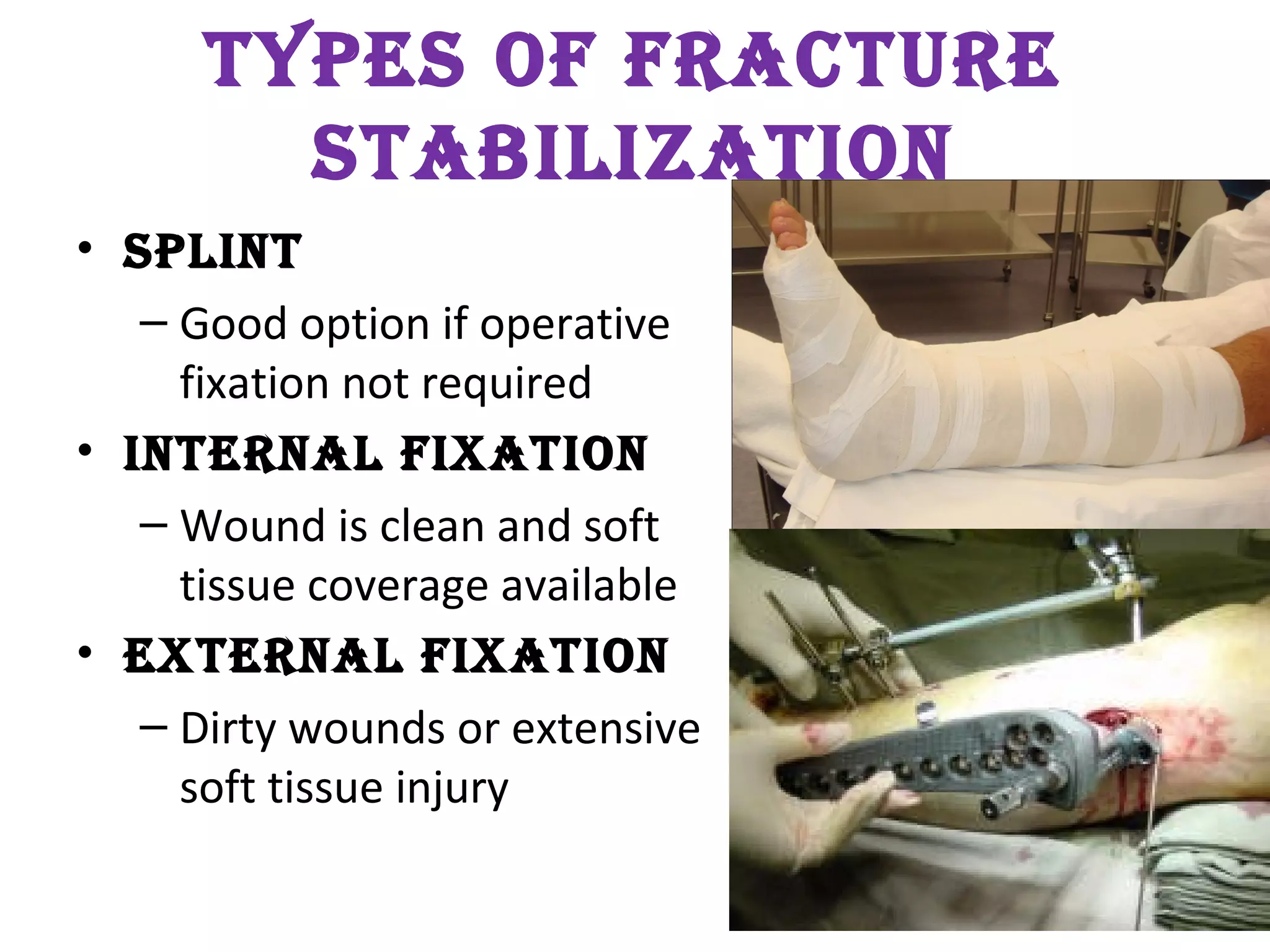 Open fractures | PPT