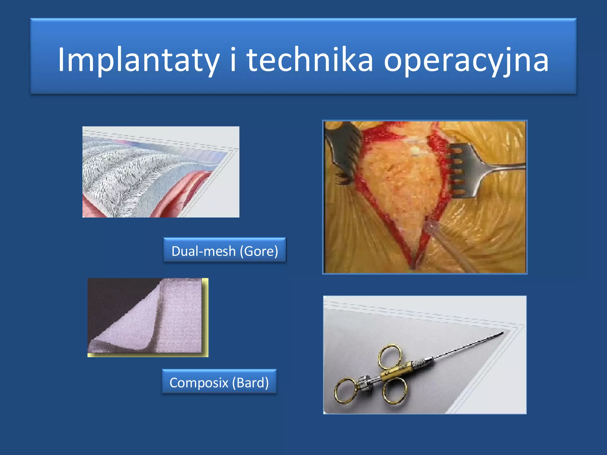 Open Ipom Ventral Hernia Repair | PPT