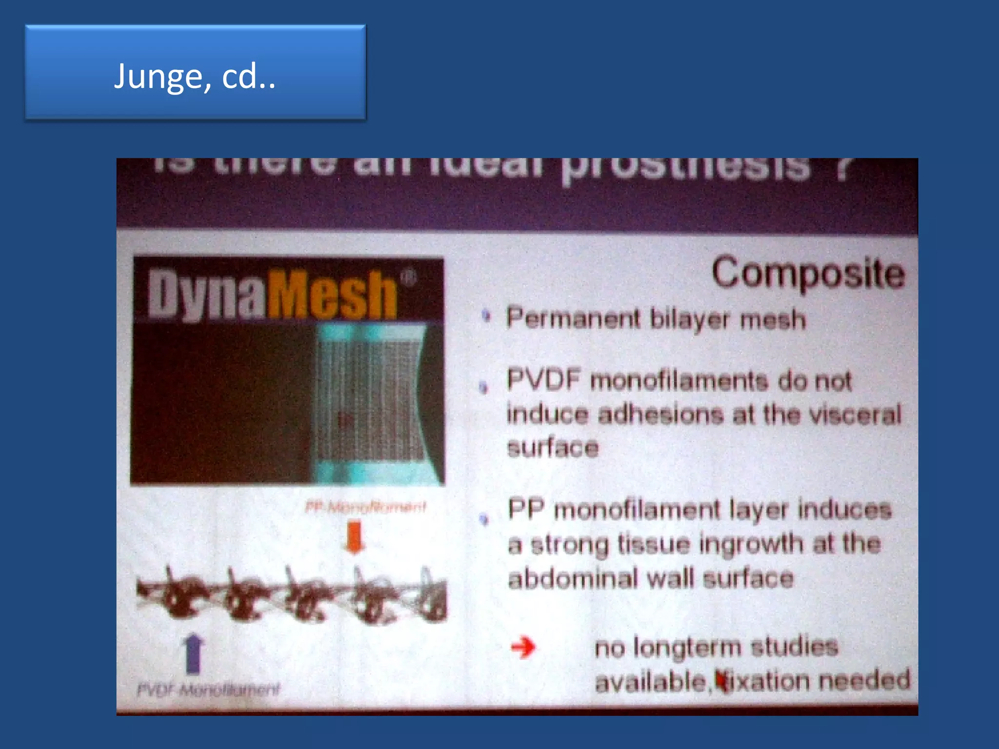 Open Ipom Ventral Hernia Repair | PPT