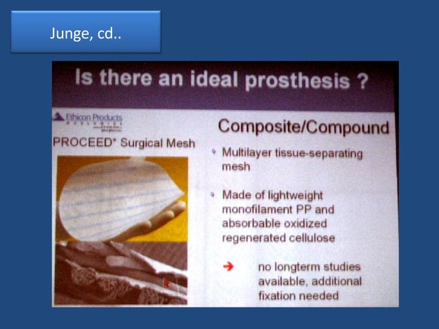 Open Ipom Ventral Hernia Repair | PPT