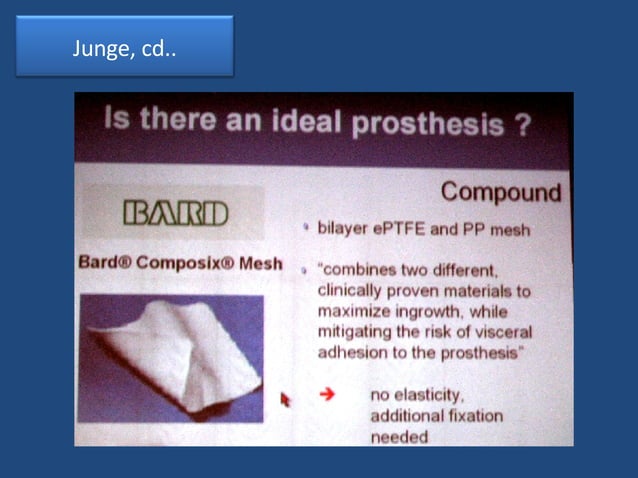 Open Ipom Ventral Hernia Repair | PPT