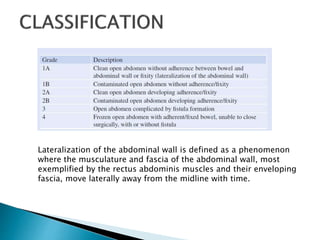 Open abdomen and its management | PPTX