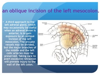 Open surgical Adrenalectomy for adrenal tumors the lect.ppt