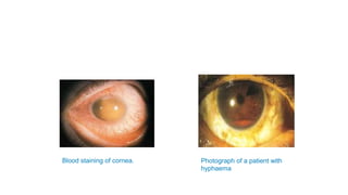 OPEN AND CLOSED INJURIES (1).pptx