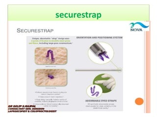 Open and laproscopic repair of incisional hernia | PPTX
