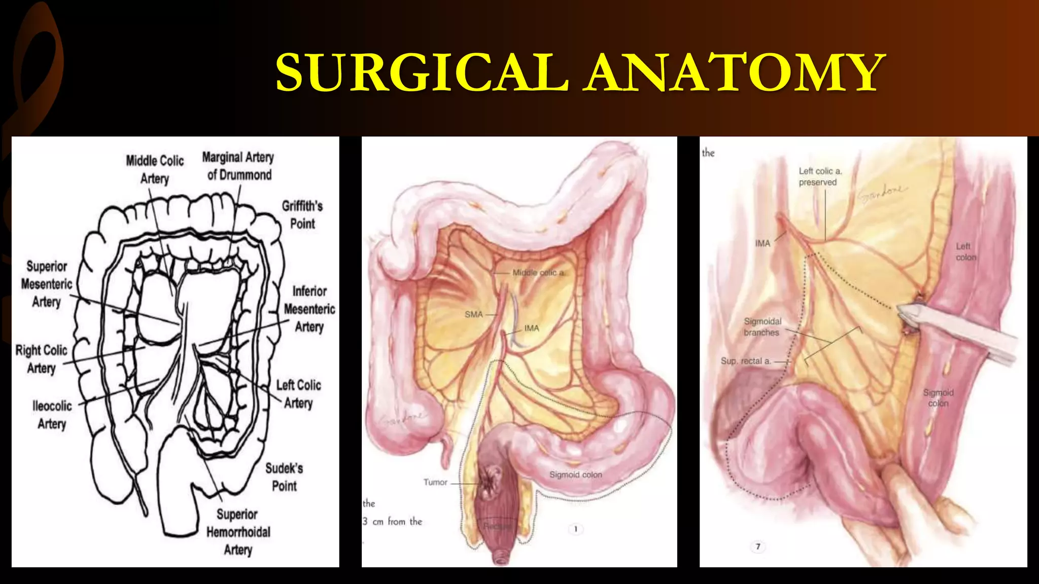 OPEN ANTERIOR RESECTION-STEP BY STEP Operative Surgery.pptx
