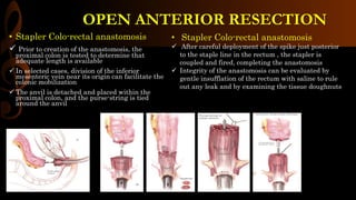 OPEN ANTERIOR RESECTION-STEP BY STEP Operative Surgery.pptx