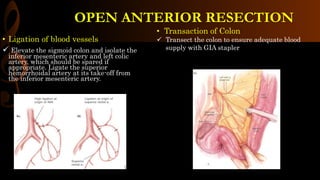 OPEN ANTERIOR RESECTION-STEP BY STEP Operative Surgery.pptx