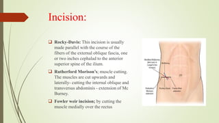 Open appendectomy | PPTX