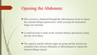 Open appendectomy | PPTX