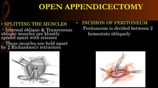 Open Appendicectomy operative surgery | PPTX