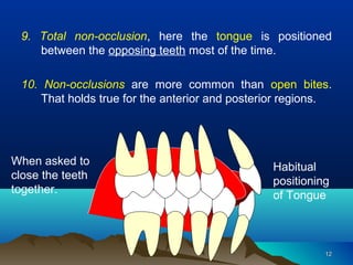 Bio mechanical considerations of Open bite. Dr. Ajay | PPT