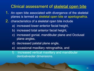 Bio mechanical considerations of Open bite. Dr. Ajay | PPT