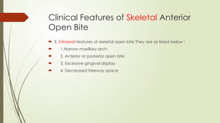 OPEN BITE THE ETIOLOGY AND MANAGEMENT .pptx