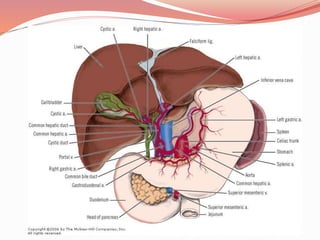 Open Vs Laparoscopic cholecystectomy | PPTX