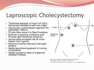 Laparoscopic Cholecystectomy Ports