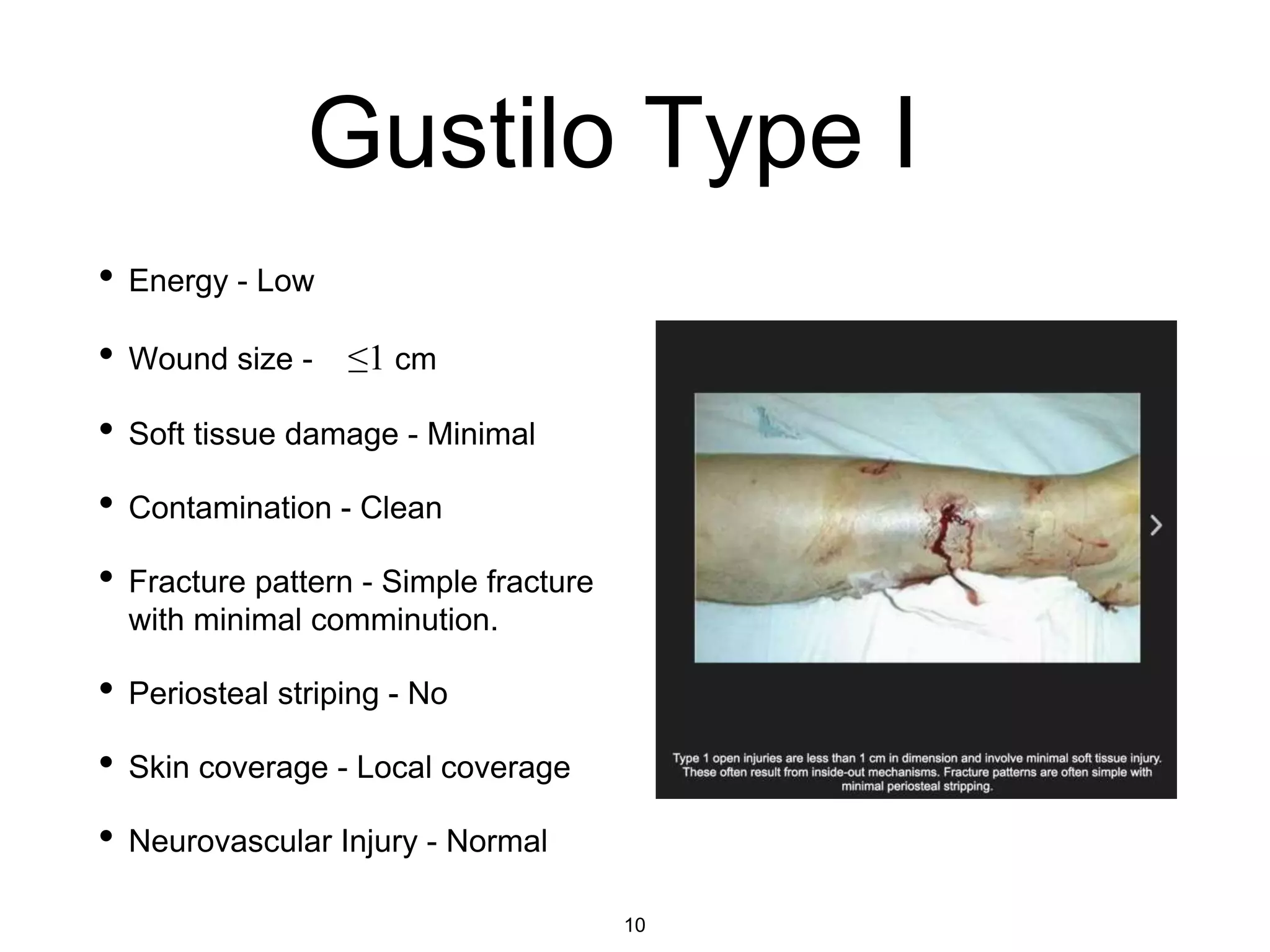 Open fracture | PPTX