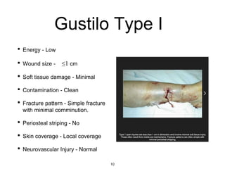 Open fracture | PPTX