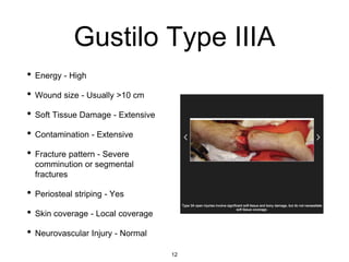 Open fracture | PPTX