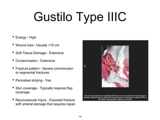 Open fracture | PPTX