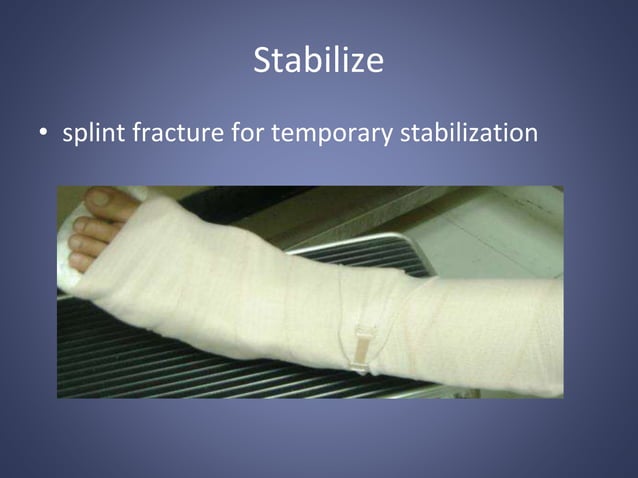 Open fracture.pptx