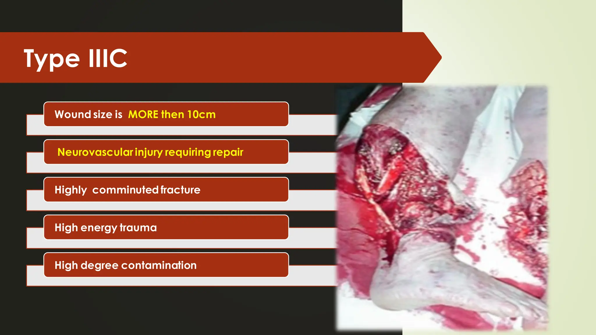 OPEN FRACTURE DEFINITION CLASSIFICATION MANAGEMENT.pdf