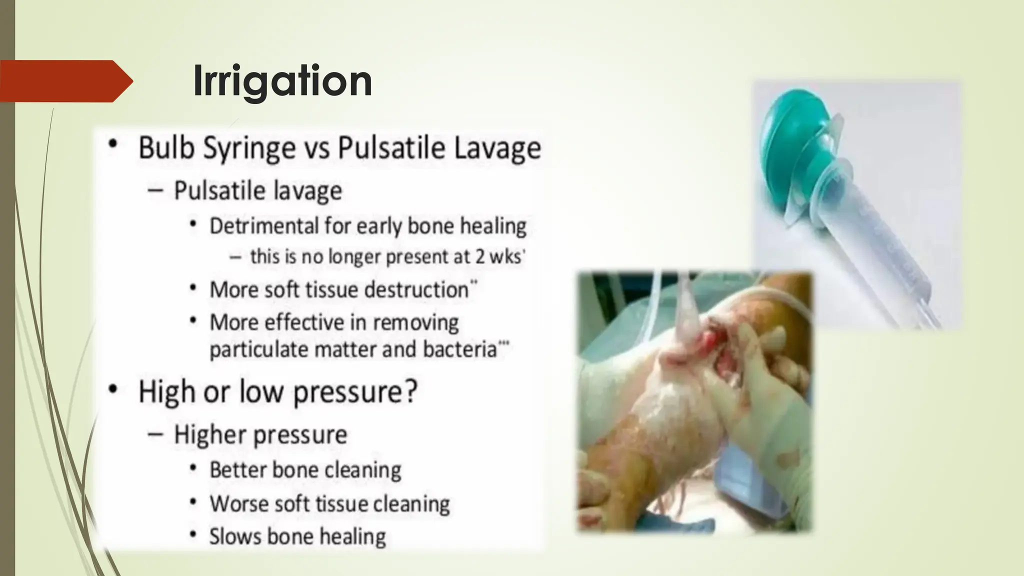 OPEN FRACTURE DEFINITION CLASSIFICATION MANAGEMENT.pdf