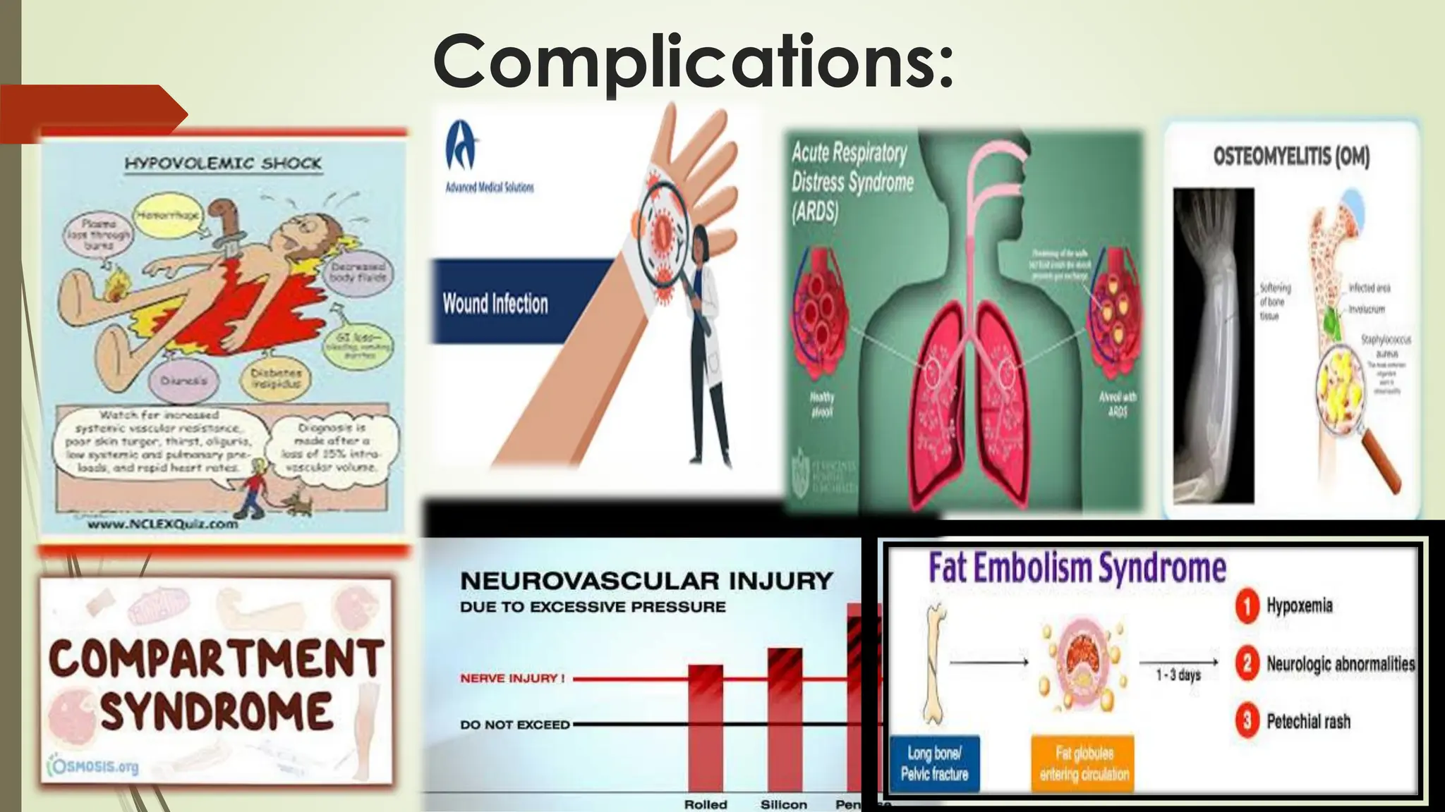 OPEN FRACTURE DEFINITION CLASSIFICATION MANAGEMENT.pdf