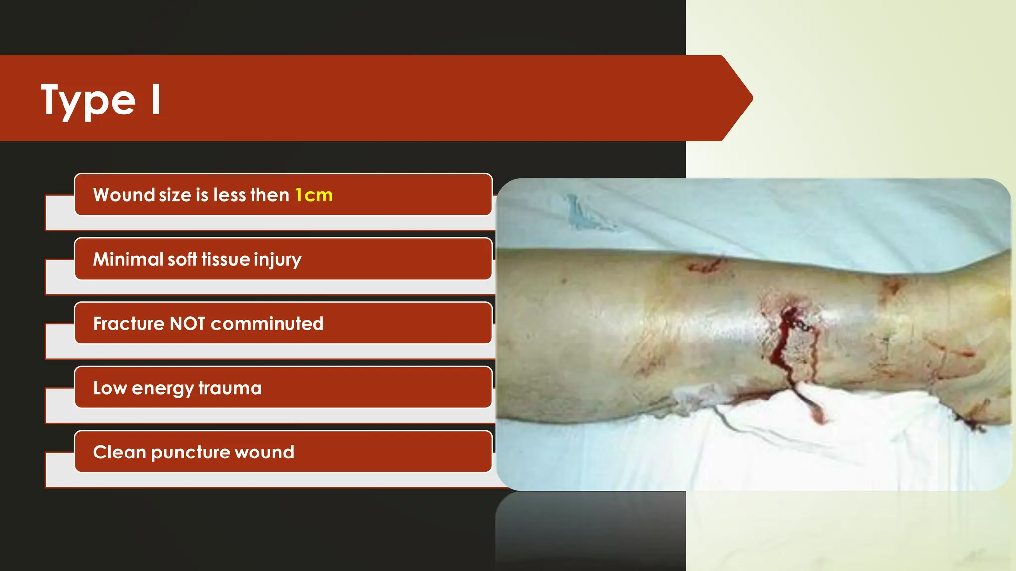 OPEN FRACTURE DEFINITION CLASSIFICATION MANAGEMENT.pdf