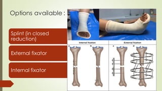 OPEN FRACTURE DEFINITION CLASSIFICATION MANAGEMENT.pdf