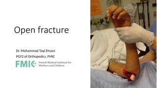 Open fracture types and management .pptx