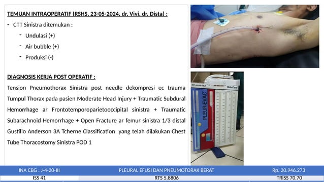 Open Fracture ar femur sinistra distal Tcherne Classification +Moderate ...