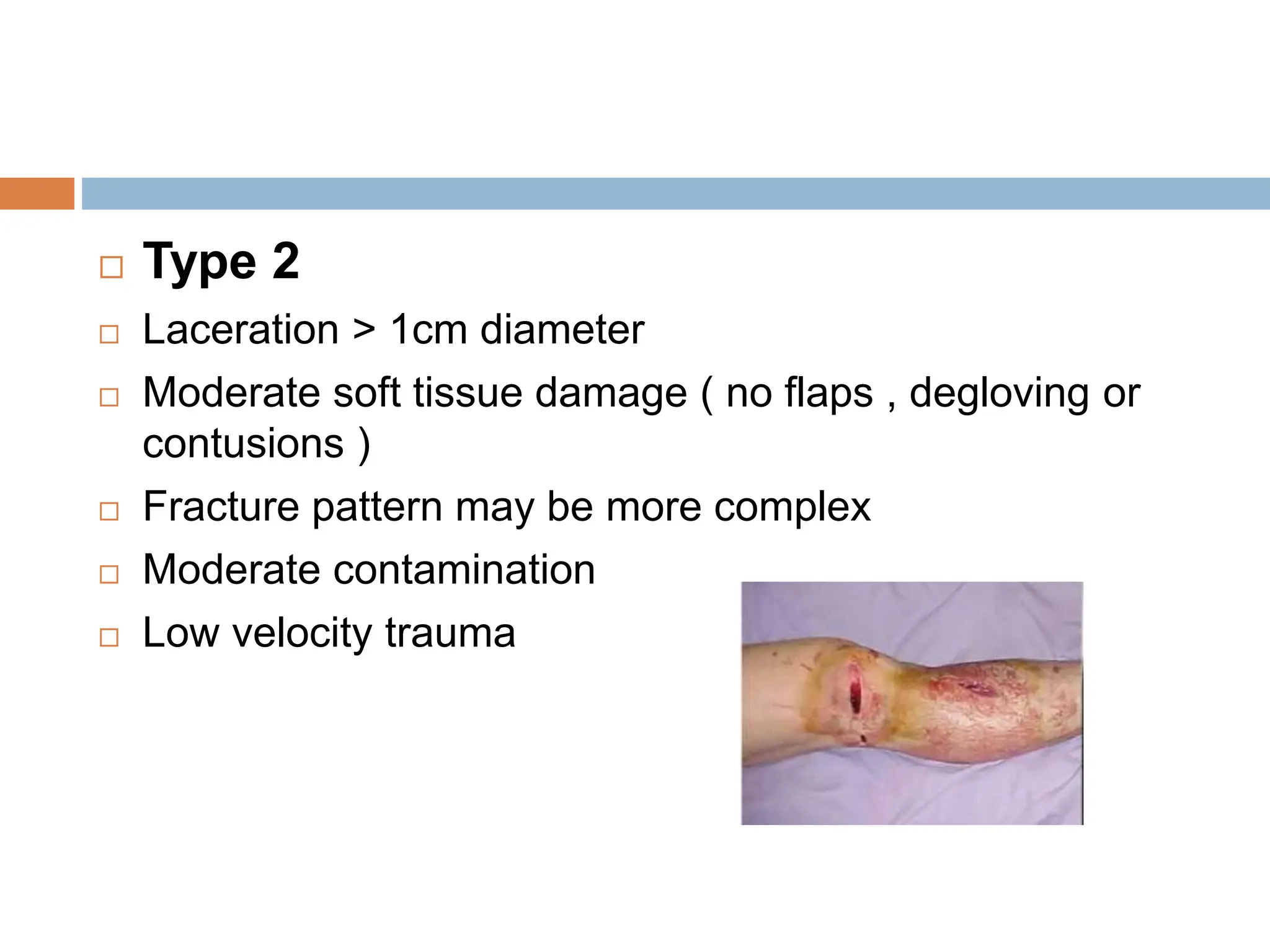 OPEN FRACTURE MANAGEMENT AND ITS COMPLICATIONS | PPT