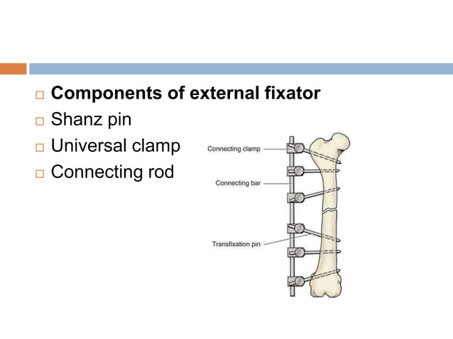 OPEN FRACTURE MANAGEMENT AND ITS COMPLICATIONS | PPT