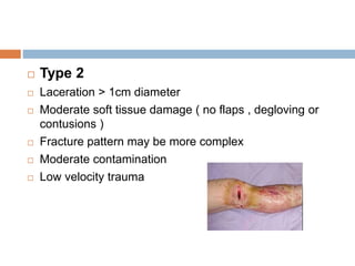 OPEN FRACTURE MANAGEMENT AND ITS COMPLICATIONS | PPT